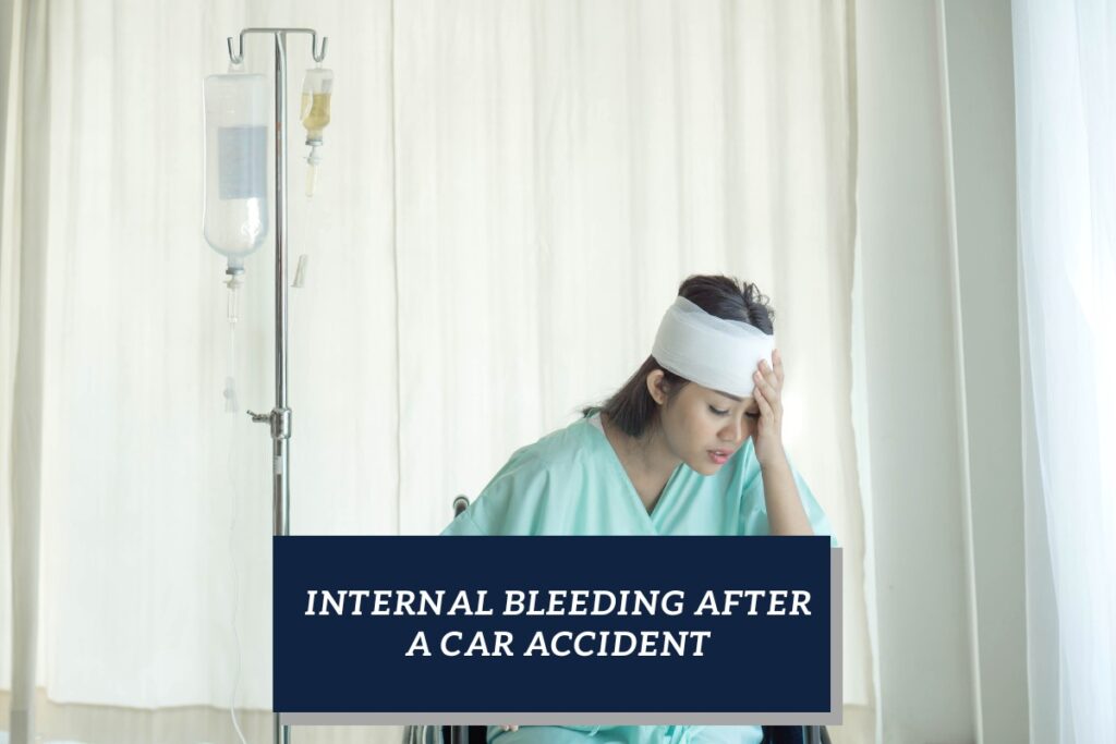 Internal Bleeding After a Car Accident - All You Need to Know